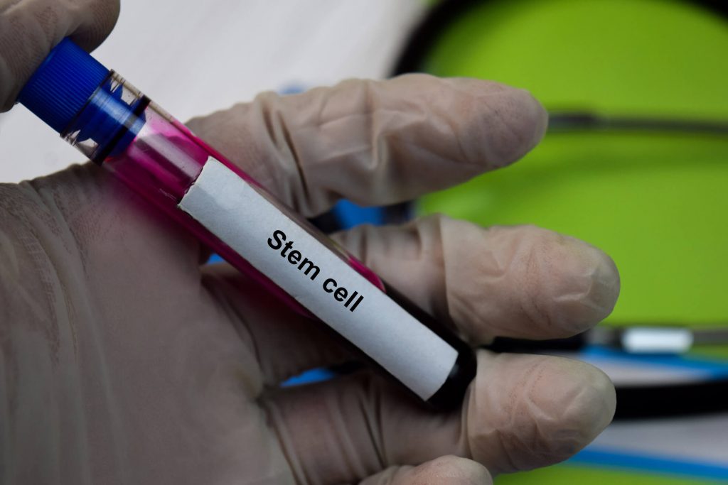 What to Expect Post Stem Cell Procedure | Advanced Stem Cell Institute